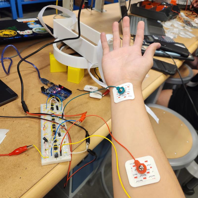 EMG Prosthetic Arm